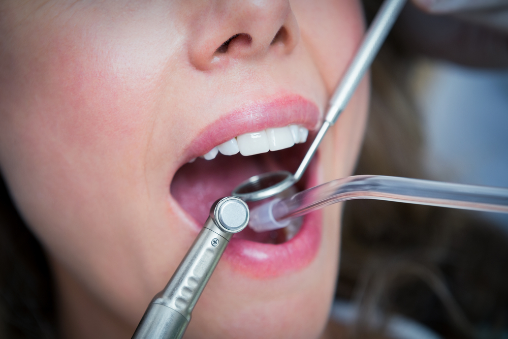 Comprehensive Dental Exams & Cleaning | Hamilton Dental Group