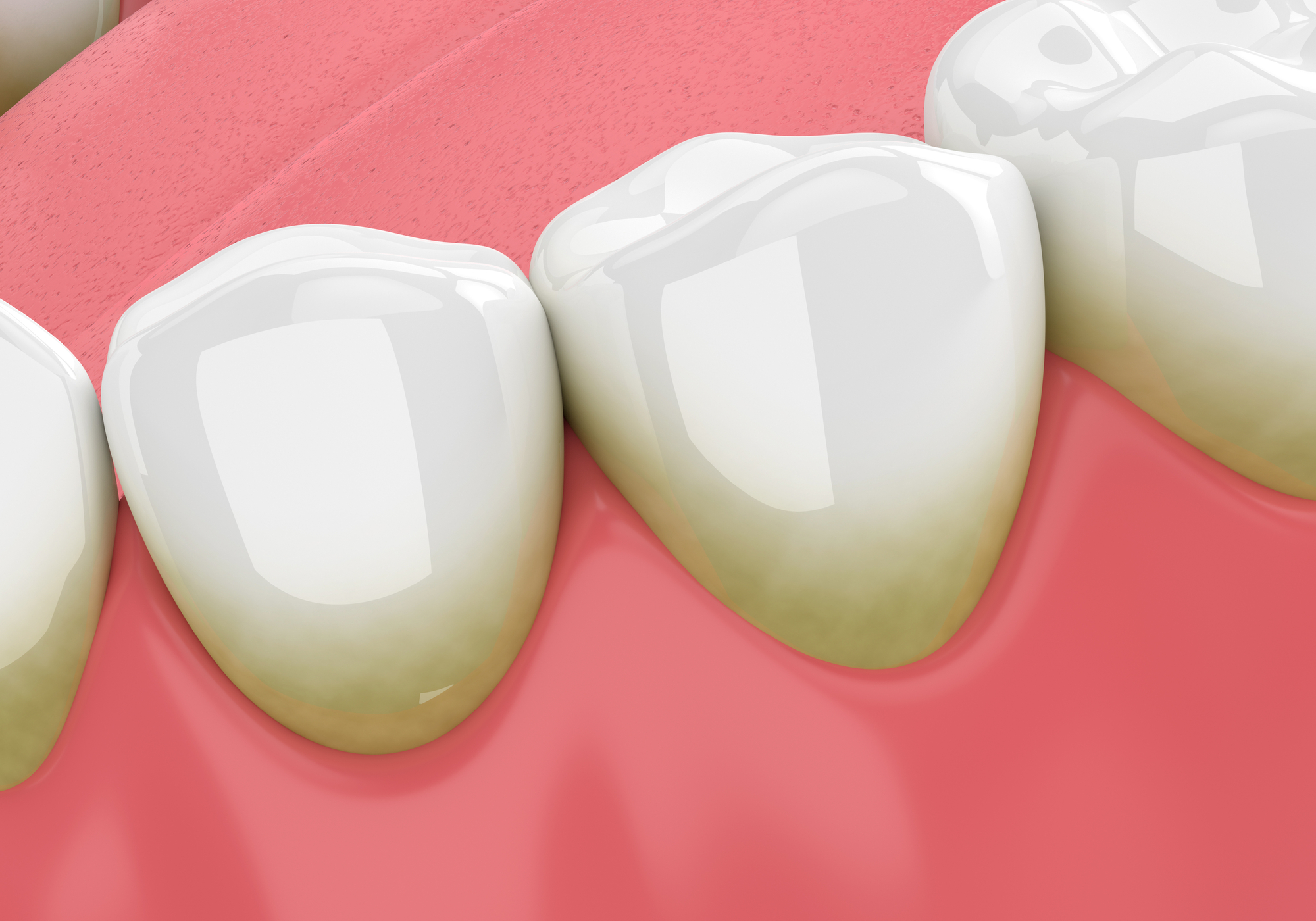 Advanced Periodontics Services | Hamilton Dental Group